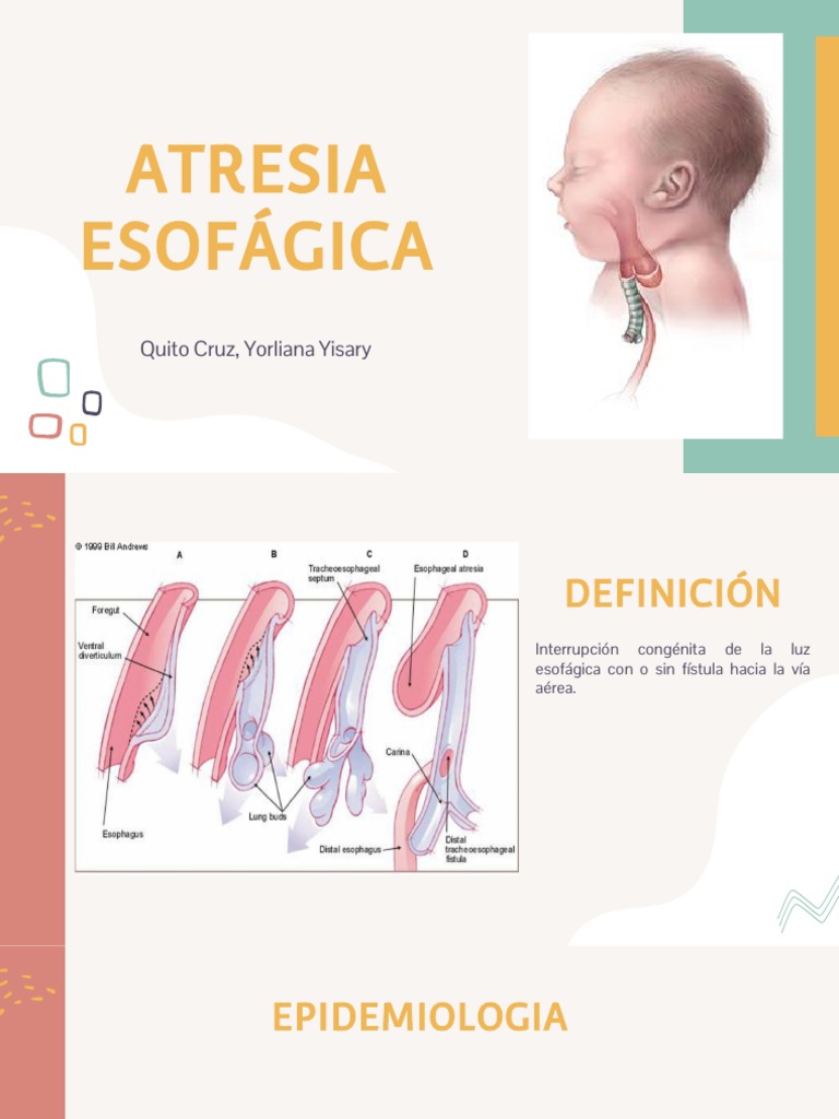 Atresia Esofagica | PDF | Ciencias de la Salud | Medicina CLINICA