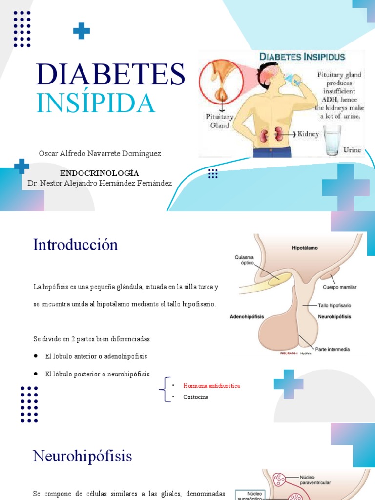 Diabetes Insípida | PDF