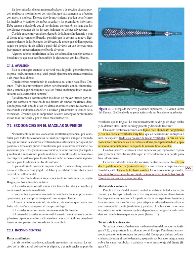 Anatomia Dentaria A La Exodoncia Con Forceps | PDF | Odontología | Diente