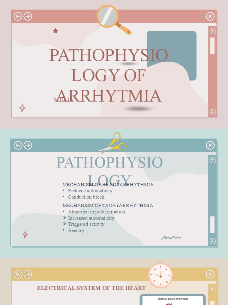 PATOFISIOLOGI ARITMIA | PDF