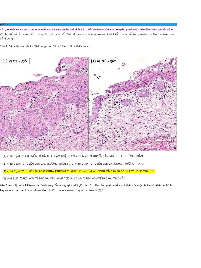 Đề GK GPB 9 7 2022 | PDF