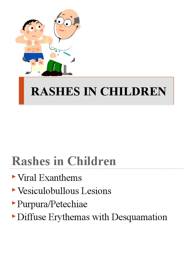 PPS UPEC PIDSP Rashes in Children Module | PDF | Herpes Simplex | Measles