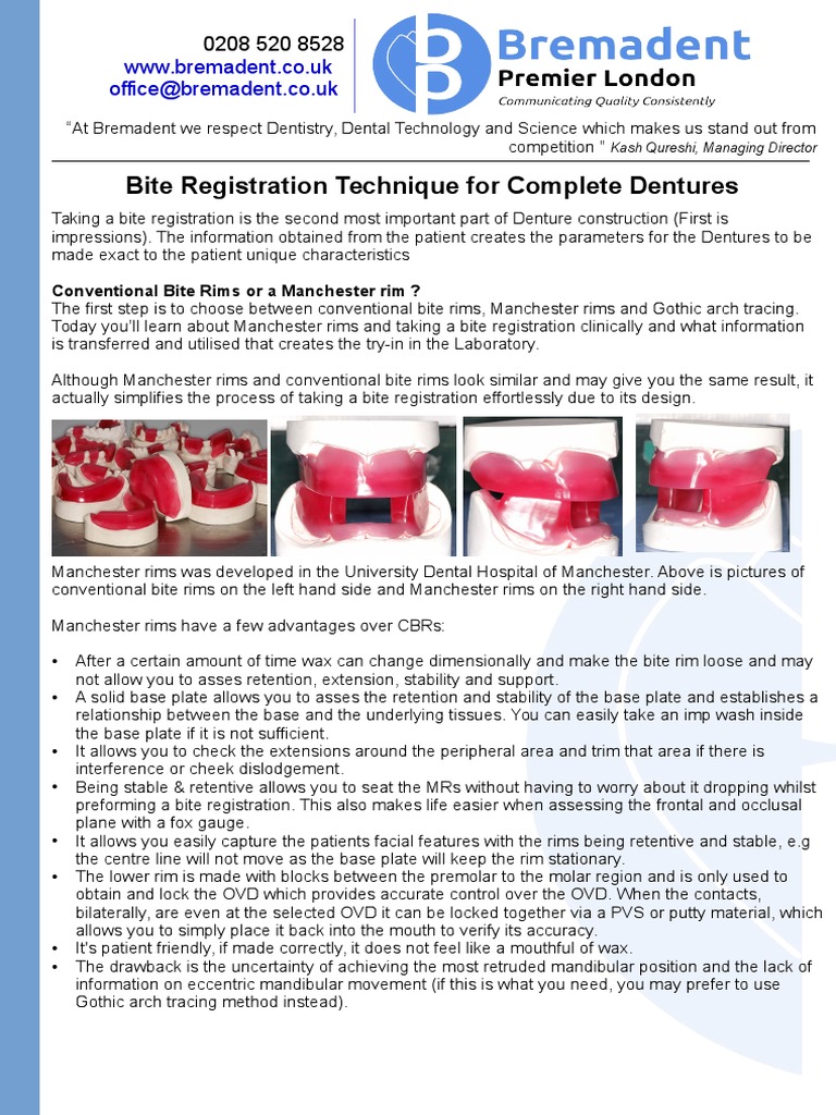 Bite Registration For Complete Dentures BPL Dental Laboratory | PDF ...
