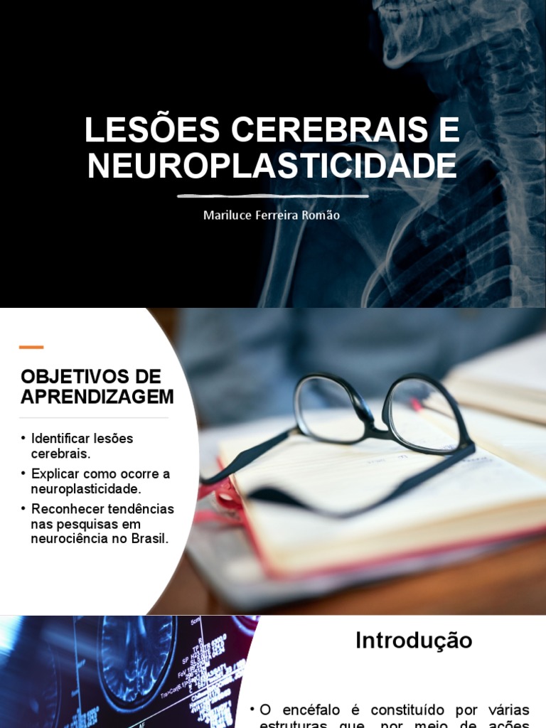 AULA 03 - Neuroplasticidade e Lesõe Cerebrais | PDF | Neuroplasticidade | Cérebro