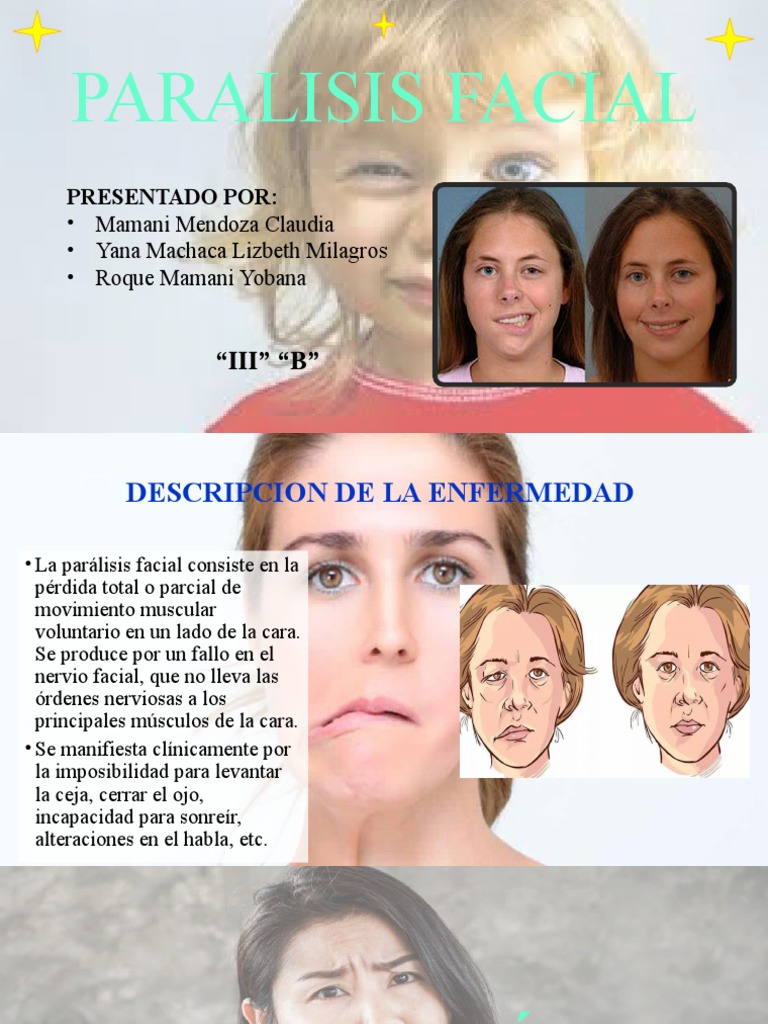 PARALISIS FACIAL - Lcy | PDF | Medicina CLINICA | Enfermedades y trastornos