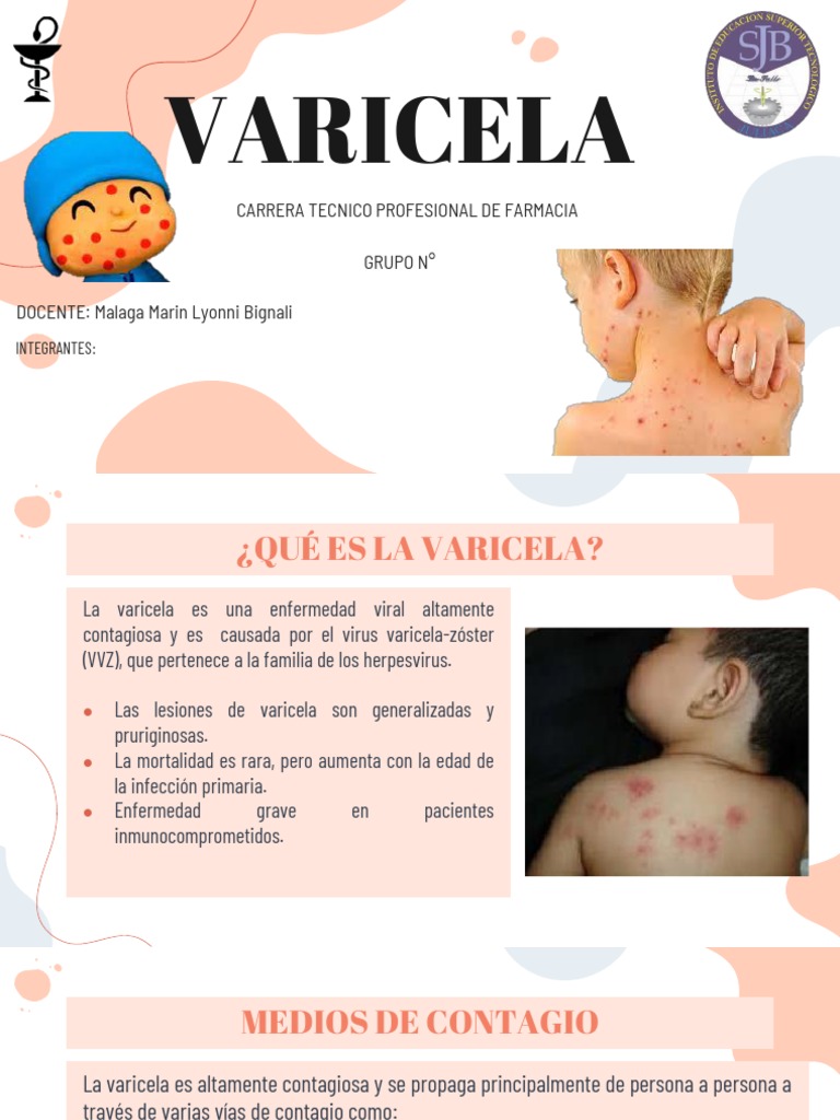 Varicela Ps | PDF | Cuidado de la salud | Enfermedades virales