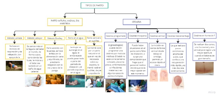 Tipos de Parto | PDF