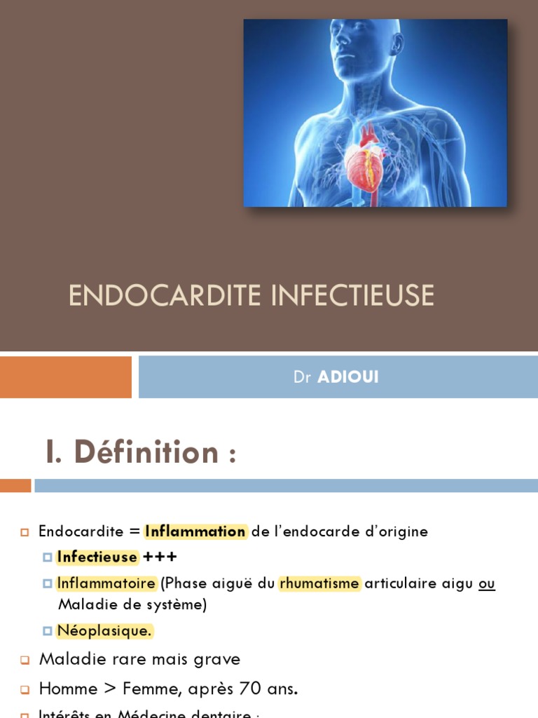 Endocardite Infectieuse : Définition et Diagnostic | PDF | Maladies ...