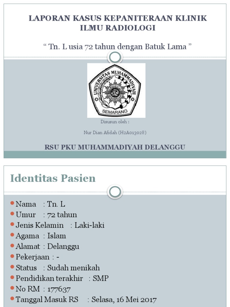PPT LAPSUS RADIOLOGI PPOK RS PKU DELANGGU NUR DIAN AFIDAH | PDF