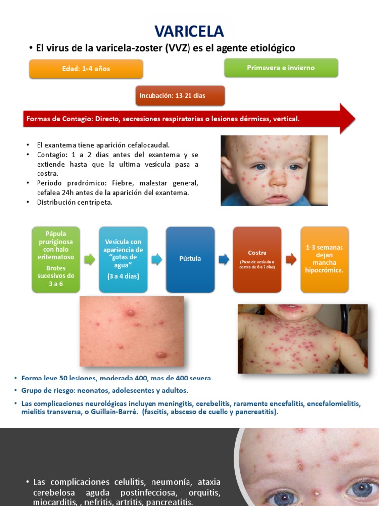 Enferm Exantem 9 | PDF | Medicina CLINICA | Enfermedades y trastornos