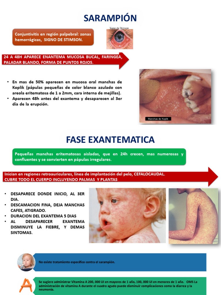 Enferm Exantem 7 | PDF | Sarampión | Especialidades Medicas