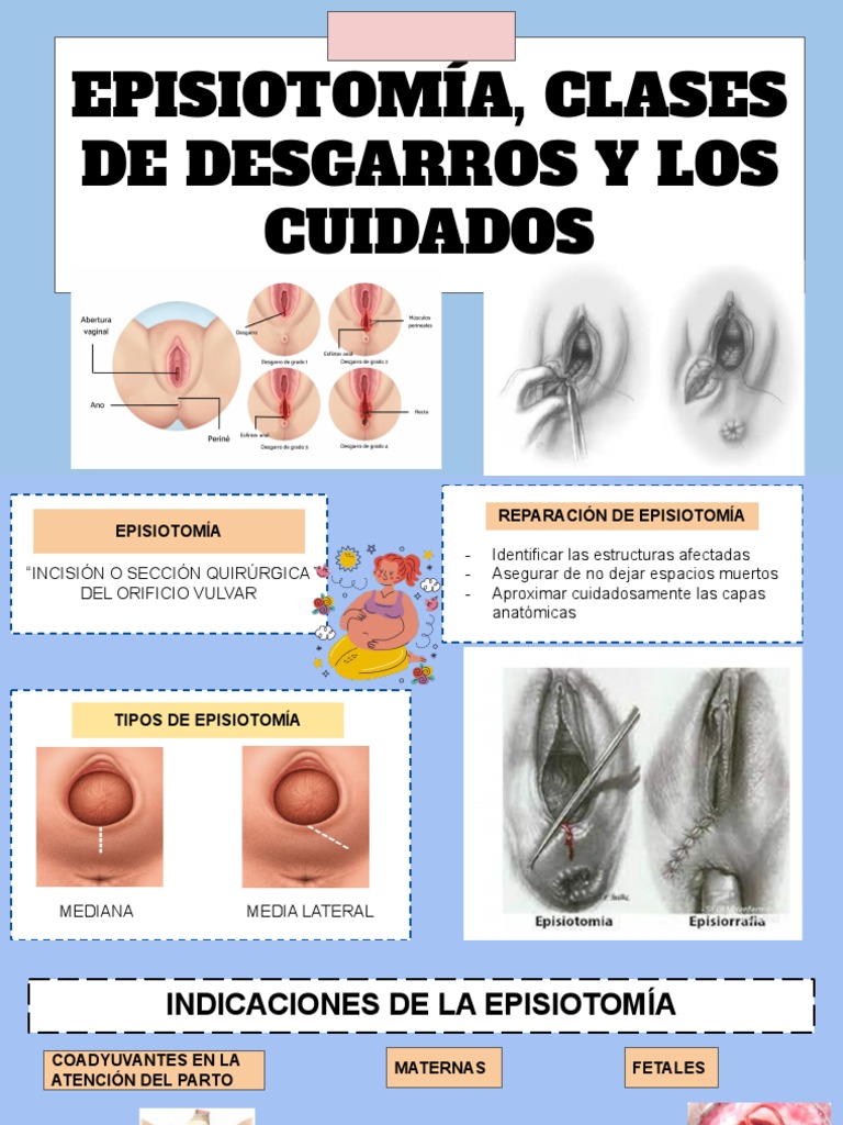 Cuidados Y Tipos De Episiotomía Pdf