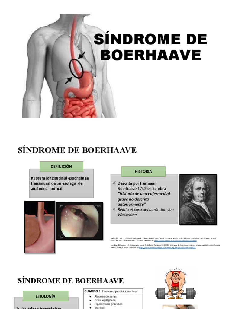 Síndrome de Boerhaave | PDF | Medicina CLINICA | Enfermedades y trastornos