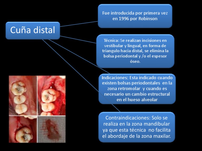 Cuna Distal | PDF