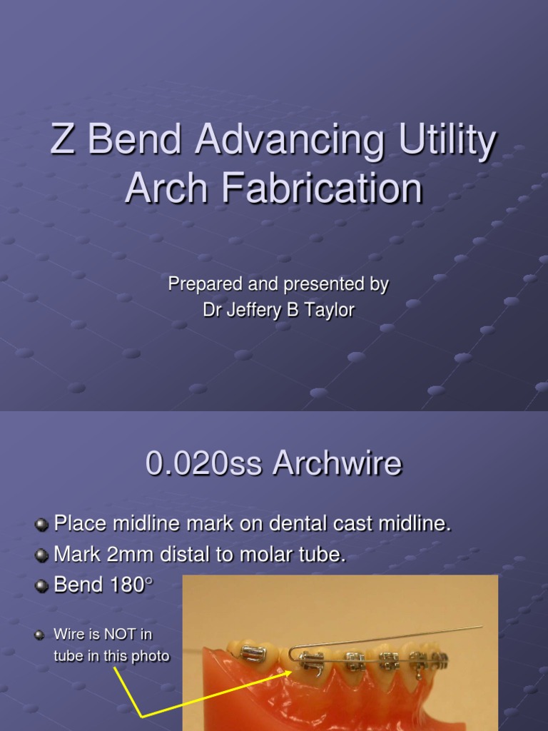 Z Bend Utility Archwire Techniques | PDF | Home & Garden | Science ...