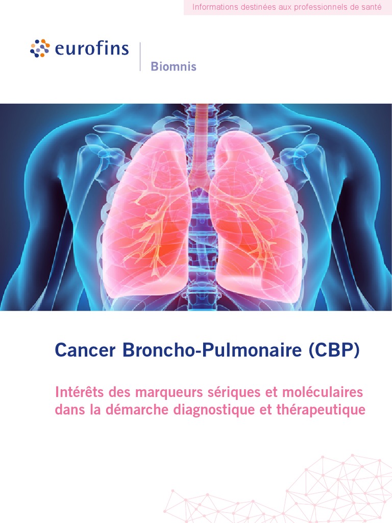 DS44 Cancer Broncho Pulmonaire | PDF | Cancer | Néoplasmes
