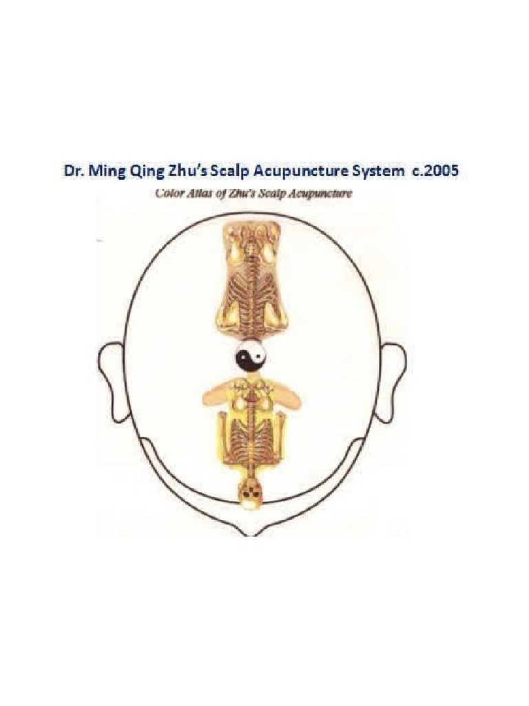Zhu Scalp Acupuncture - Chart | PDF