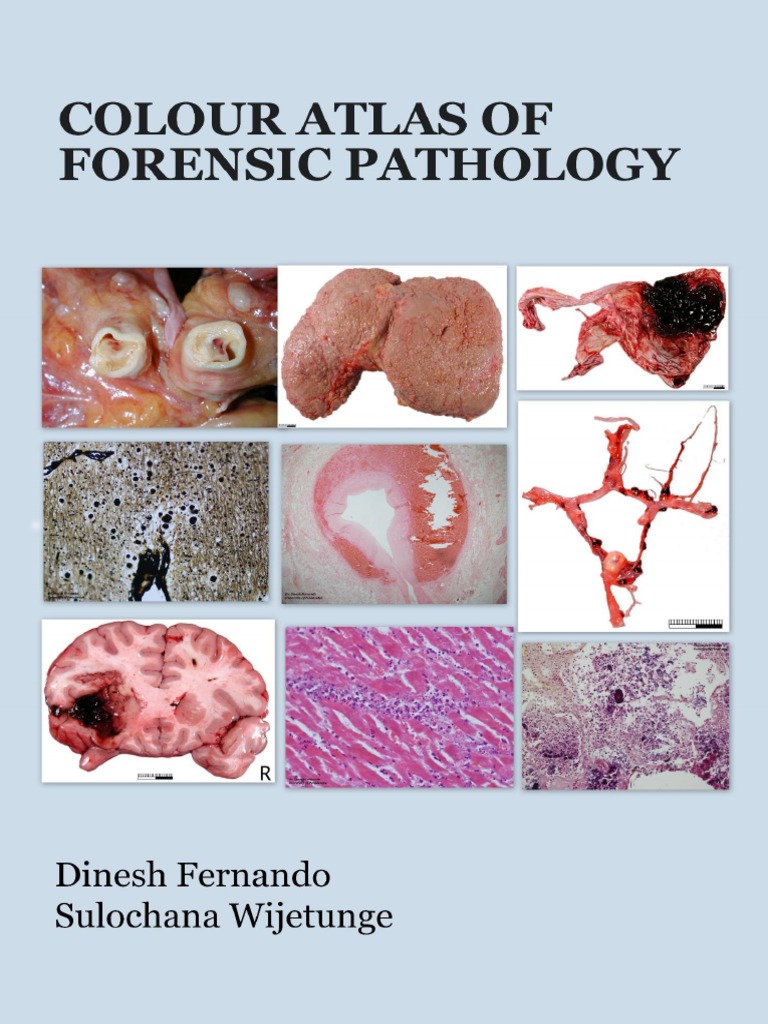 Color Atlas of Forensic Pathology by Dinesh Fernando and Sulochana ...