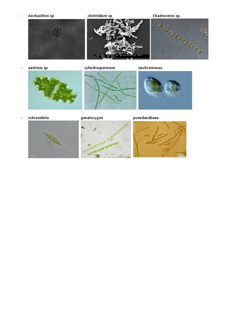 Anchanthes sp clostridium sp Chaetoceros sp | PDF
