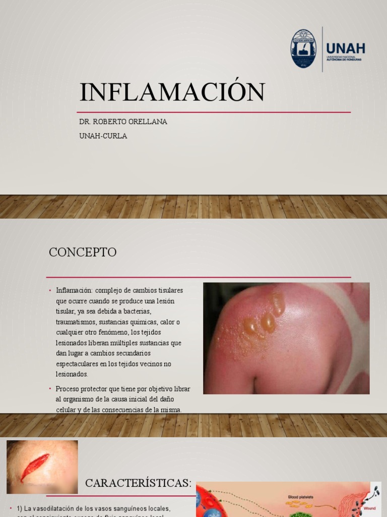 Características y Tipos de Inflamación | PDF | Inflamación | Biología ...