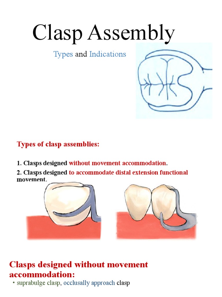 Lec 11 Clasp Assembly | PDF | Mouth | Dentistry Branches