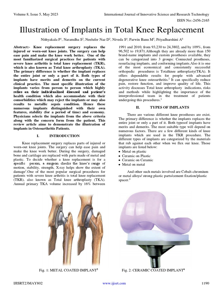 Illustration of Implants in Total Knee Replacement | PDF | Knee | Musculoskeletal System