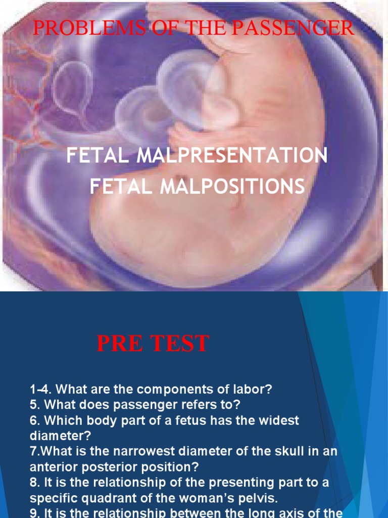 Fetal Malpresentation | PDF | Childbirth | Caesarean Section