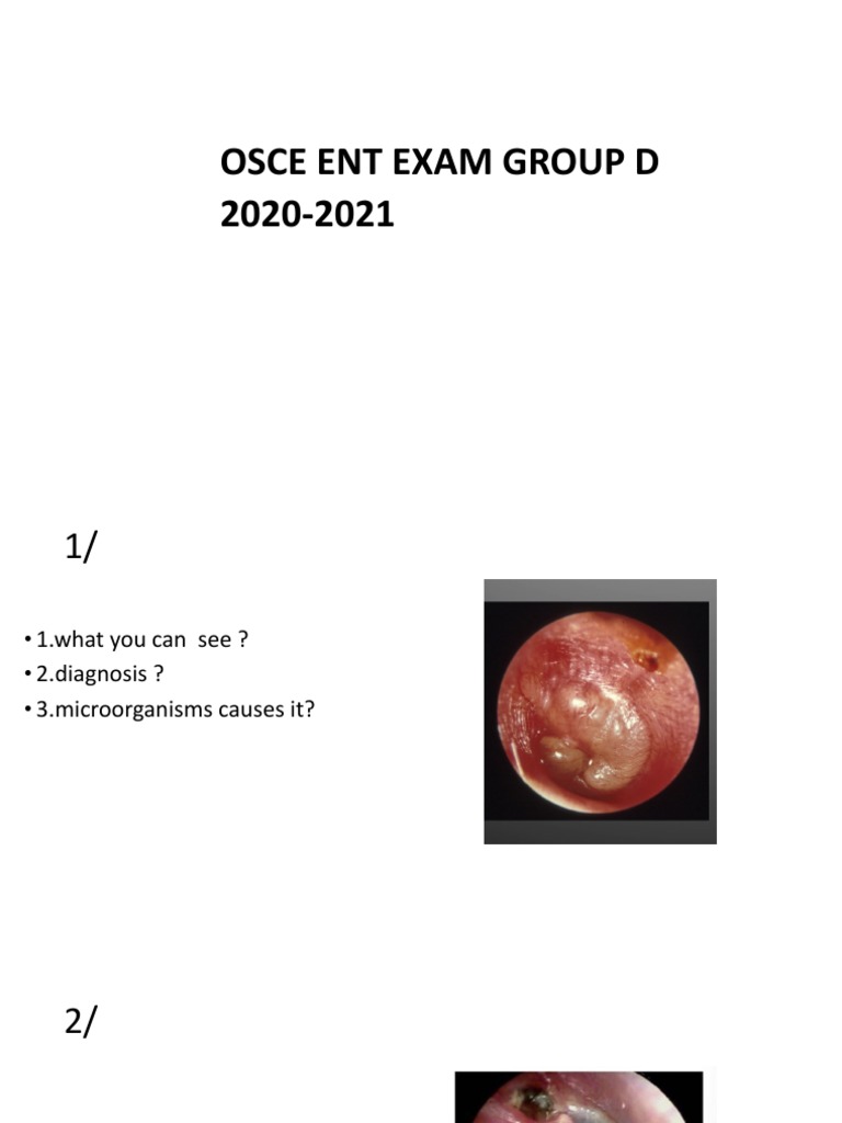 Ent Osce 2021 | PDF