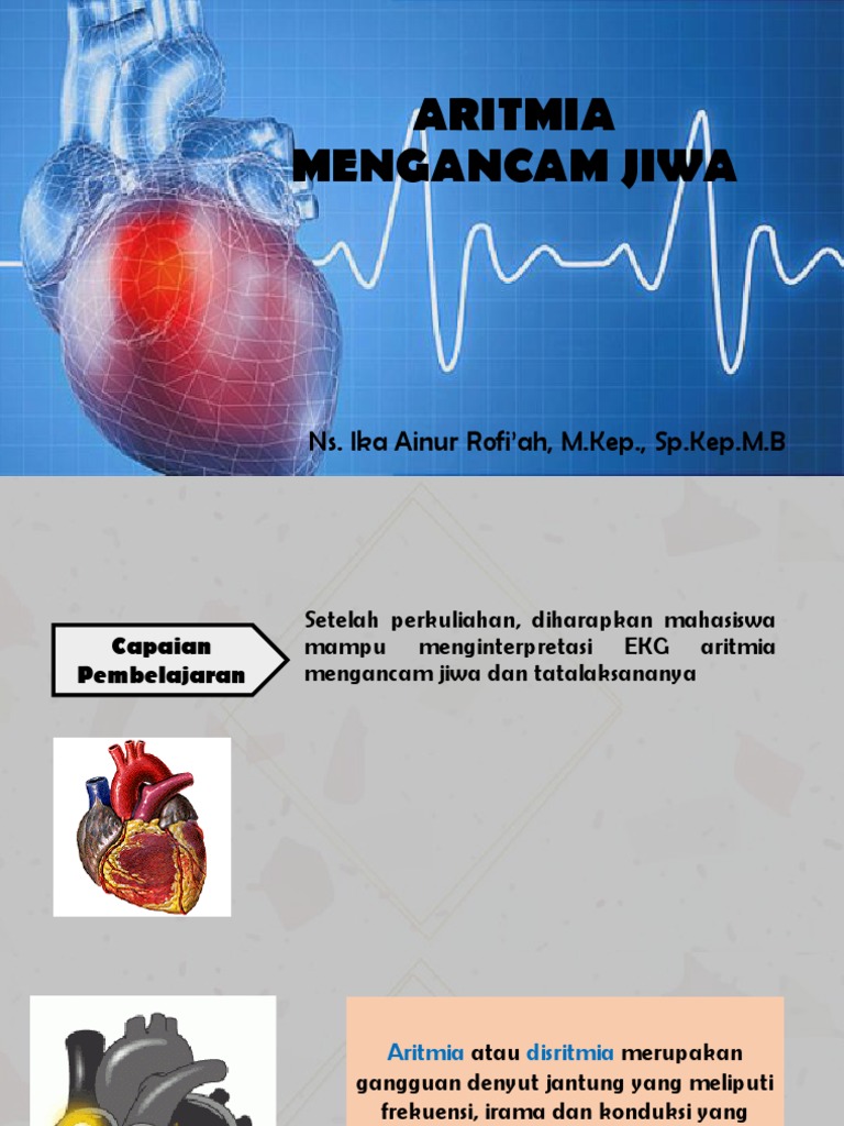 Aritmia Lethal | PDF