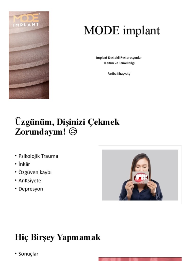 MODE Implant: İmplant Destekli Restorasyonlar Tanıtım Ve Temel Bilgi ...