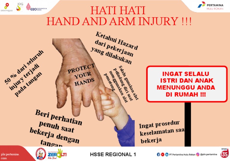 Hand and Arm Injury | PDF