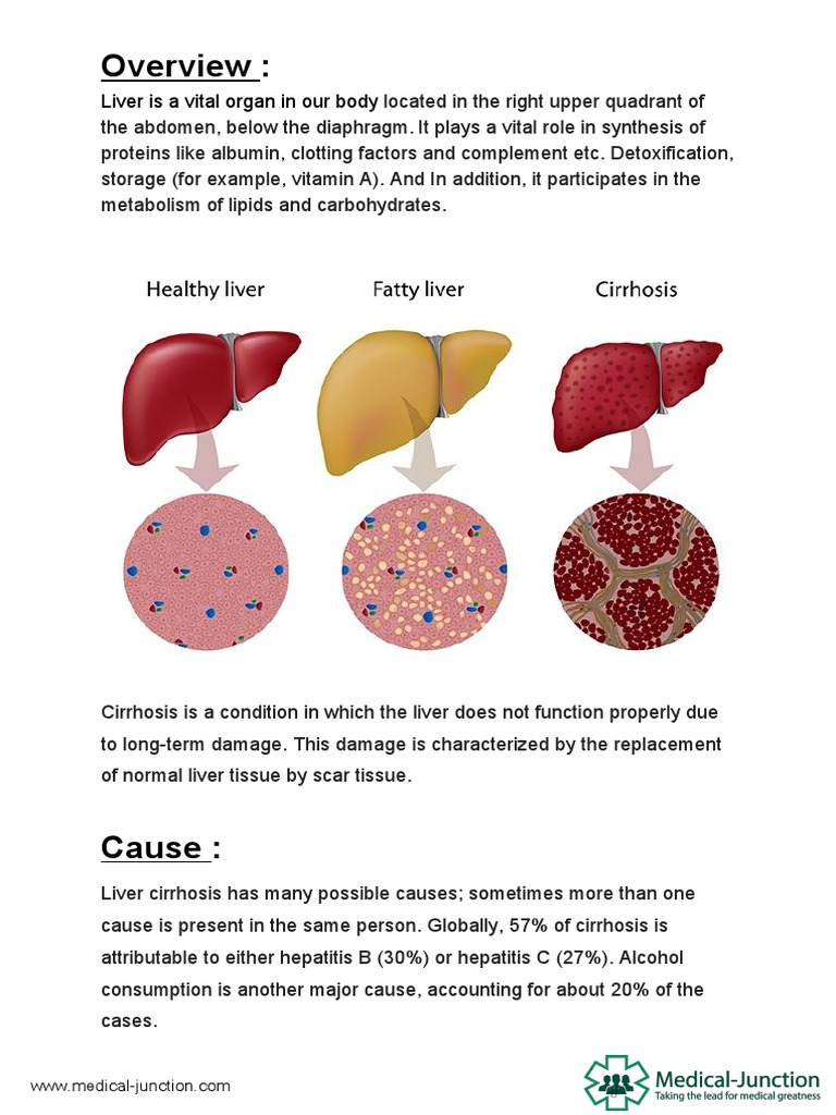 Liver Cirrhosis | PDF | Cirrhosis | Liver