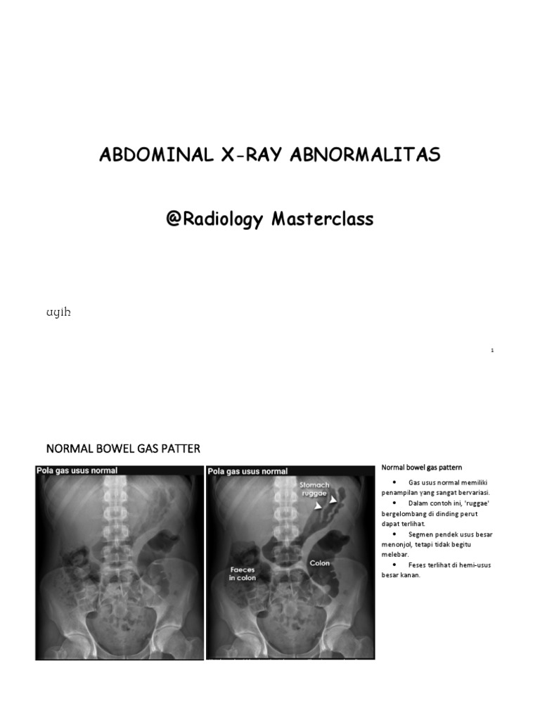 ABDOMINAL Xray | PDF