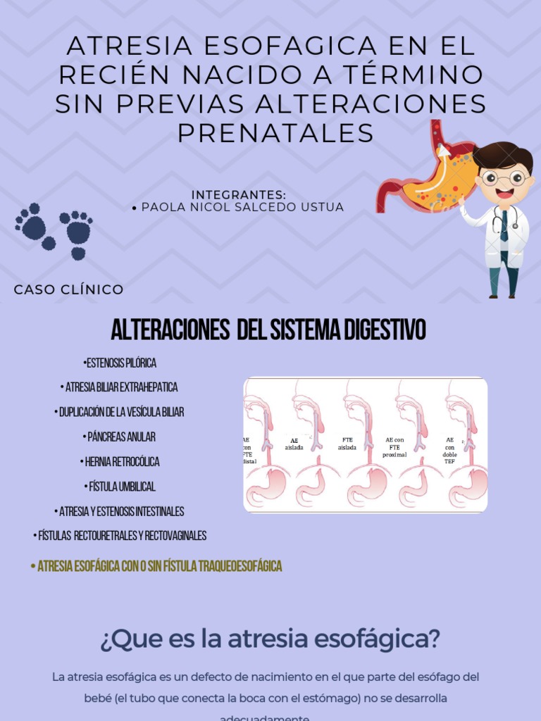 Atresia Esofágica en Recién Nacidos | PDF | Esófago | Sistema digestivo ...