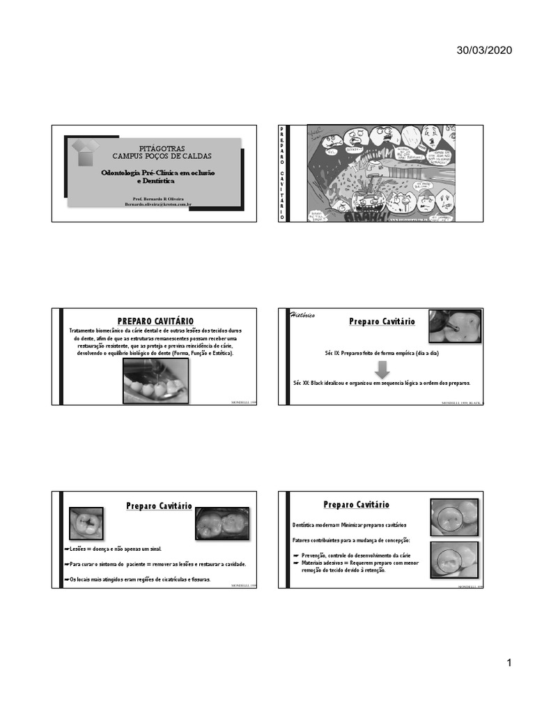 Aula 6 Preparo Cavitário CL I | PDF | Boca | Odontologia