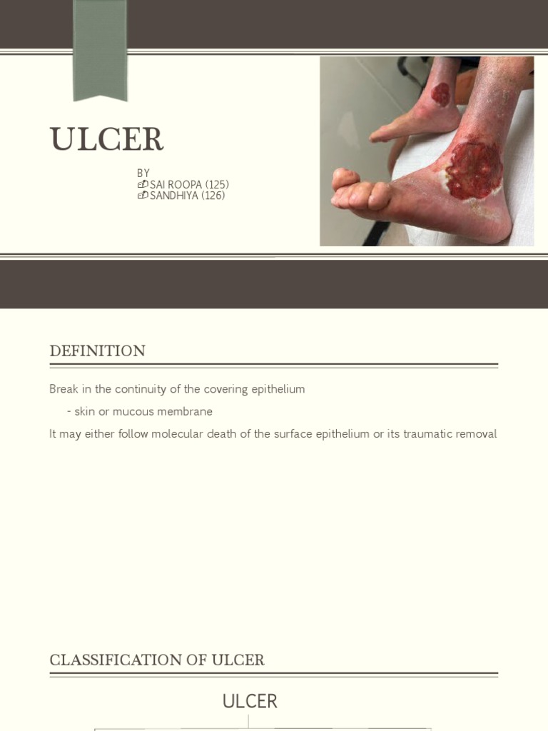 ULCER | PDF | Health Sciences | Clinical Medicine