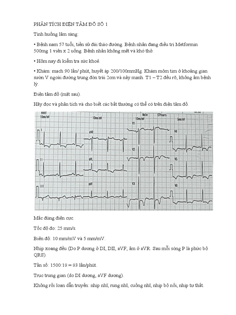 PHÂN TÍCH ĐIỆN TÂM ĐỒ SỐ 1 | PDF