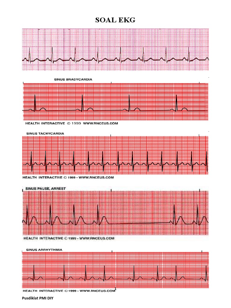 Soal Ekg | PDF