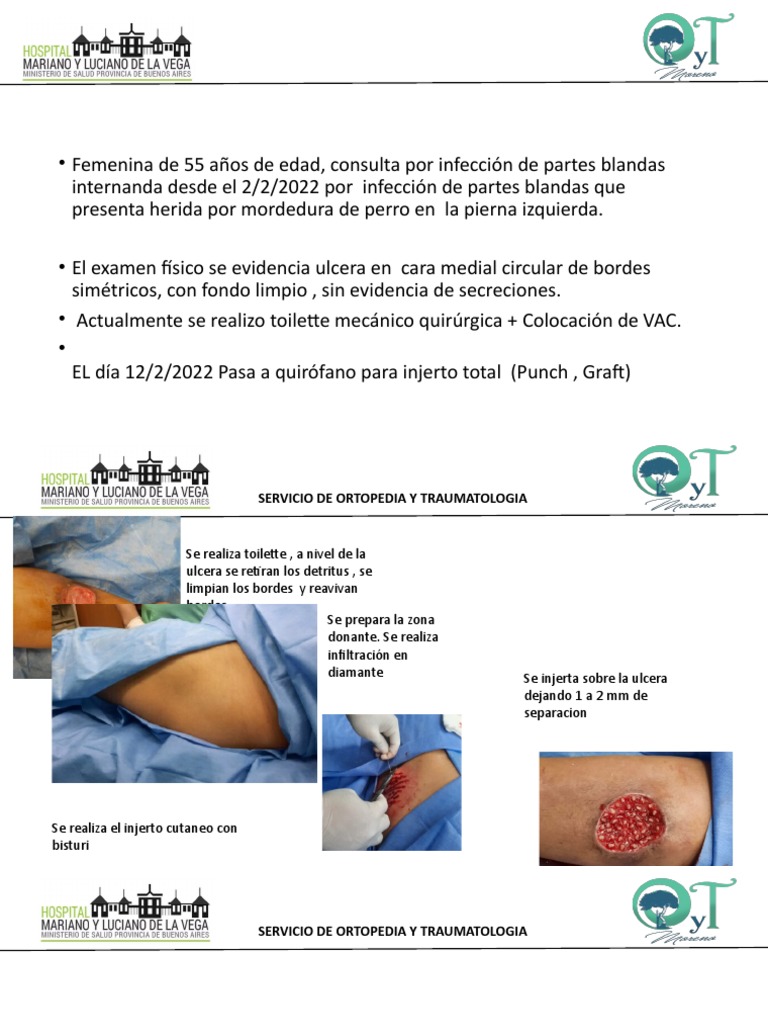 Injertos y Colgajos en Piel J Principios y Generalidades | PDF ...