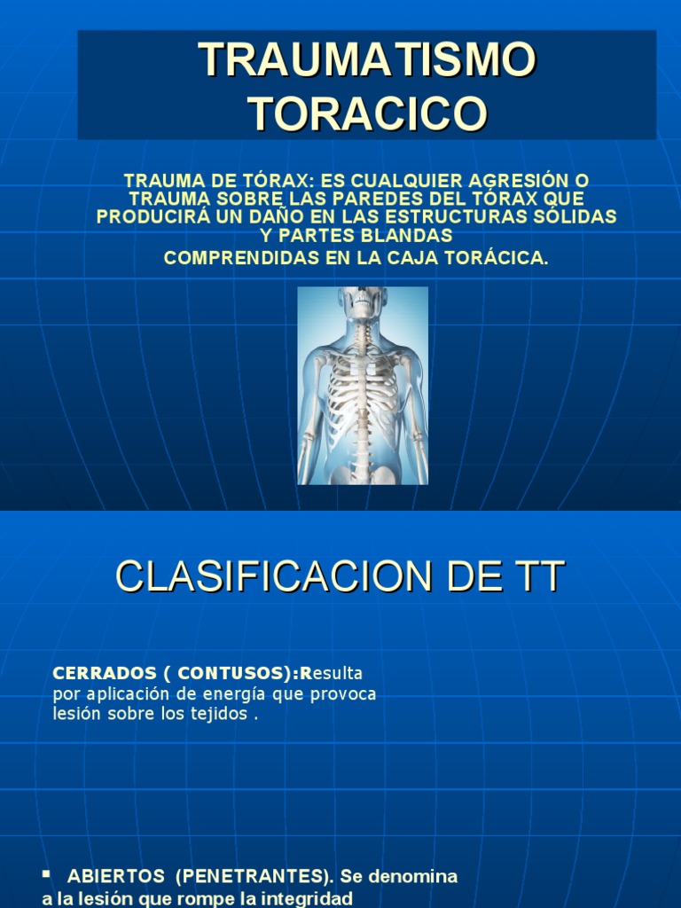 Traumatismo Toracico | PDF