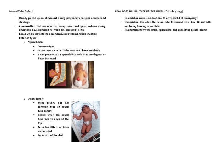 Neural Tube Defect | PDF