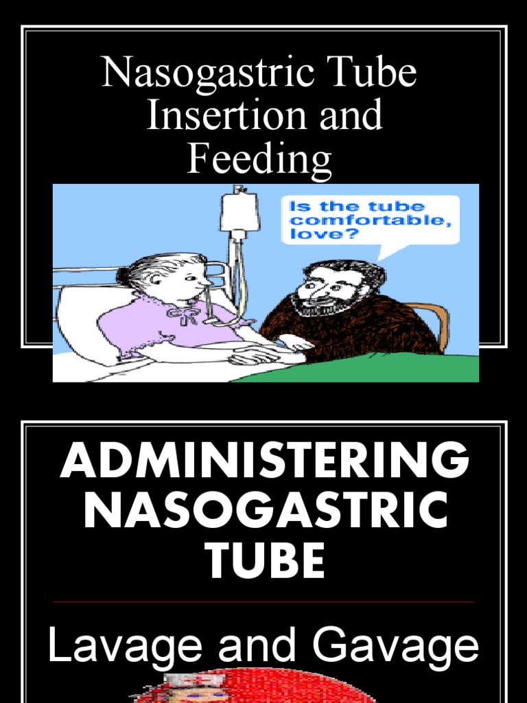 Nasogastric Tube Insertion & Feeding | PDF