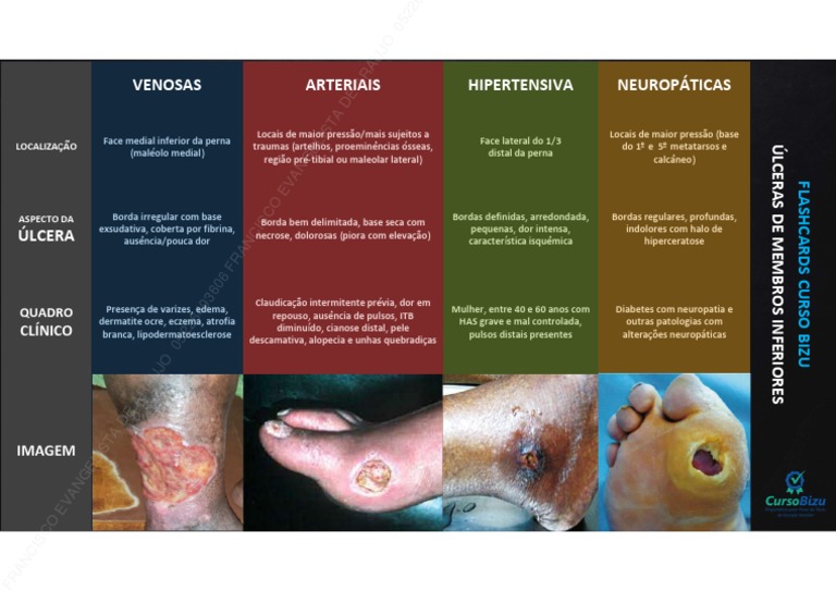 Ulceras de Membros Inferiores | PDF | Angiologia | Doenças e distúrbios ...
