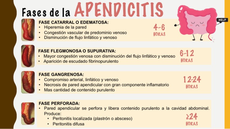 APENDICITIS | PDF