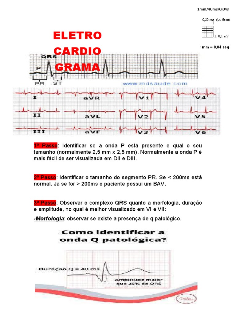 Eletro PH | PDF | Eletrocardiografia | Medicina Clínica