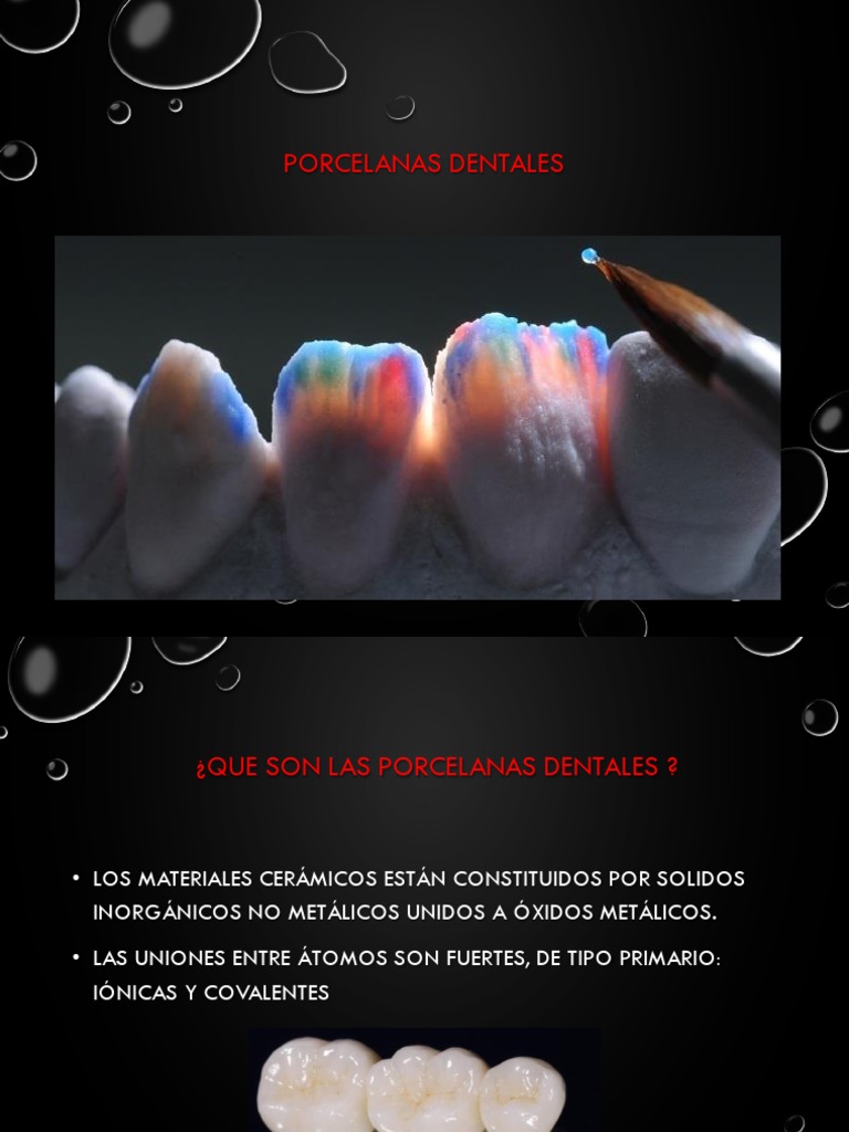Características y Usos de Porcelanas Dentales | PDF | Cerámica | Óxido ...