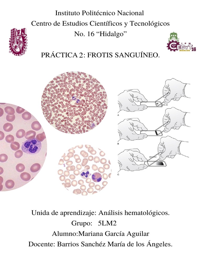 Práctica 1 Frotis Sanguíneo. | PDF | Sangre | Especialidades Medicas