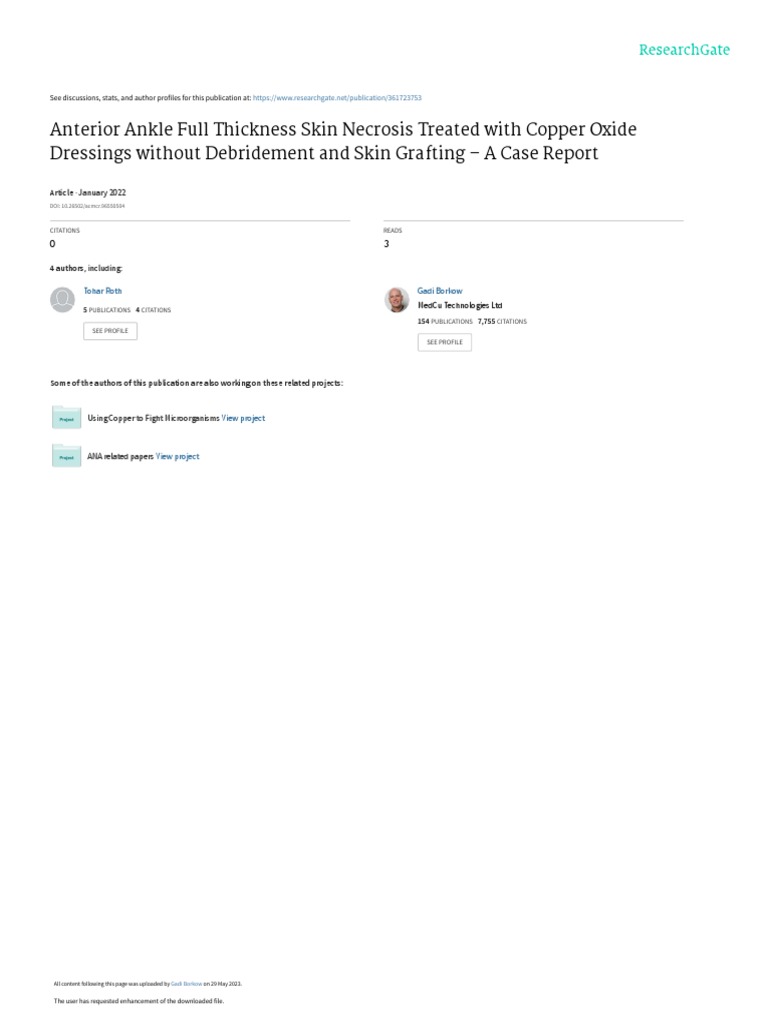 Anterior Ankle Full Thickness Skin Necrosis Treated With Copper Oxide ...