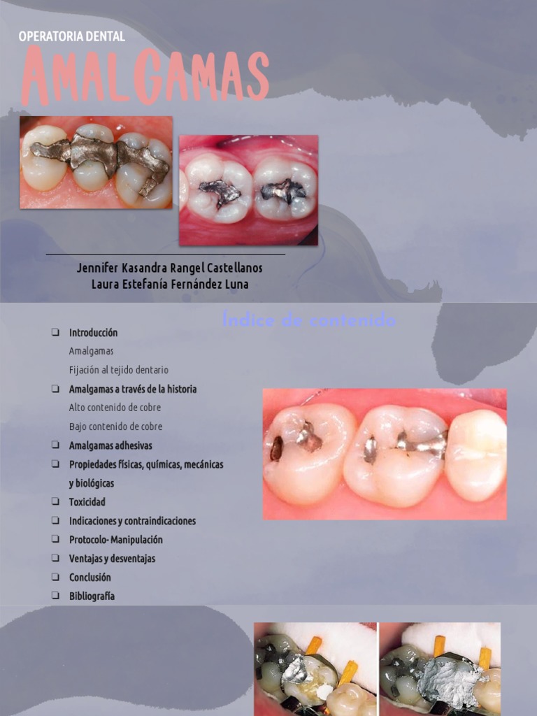 Protocolo de Manipulación de Amalgama Dental | PDF | Mercurio (Elemento ...