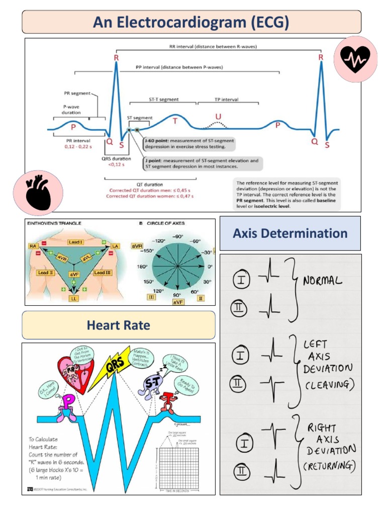 ECG Poster | PDF